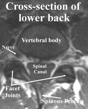 Lower BacK Cross-section Picture